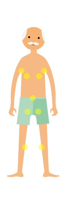 Huidverzorging bij smetten - Abena Zorgprofessional Portaal